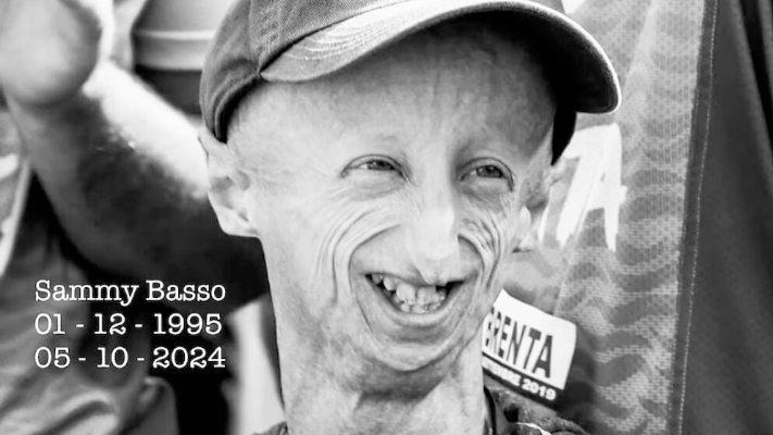 Murió Sammy Basso, el italiano de 28 años que visibilizó el síndrome de ...